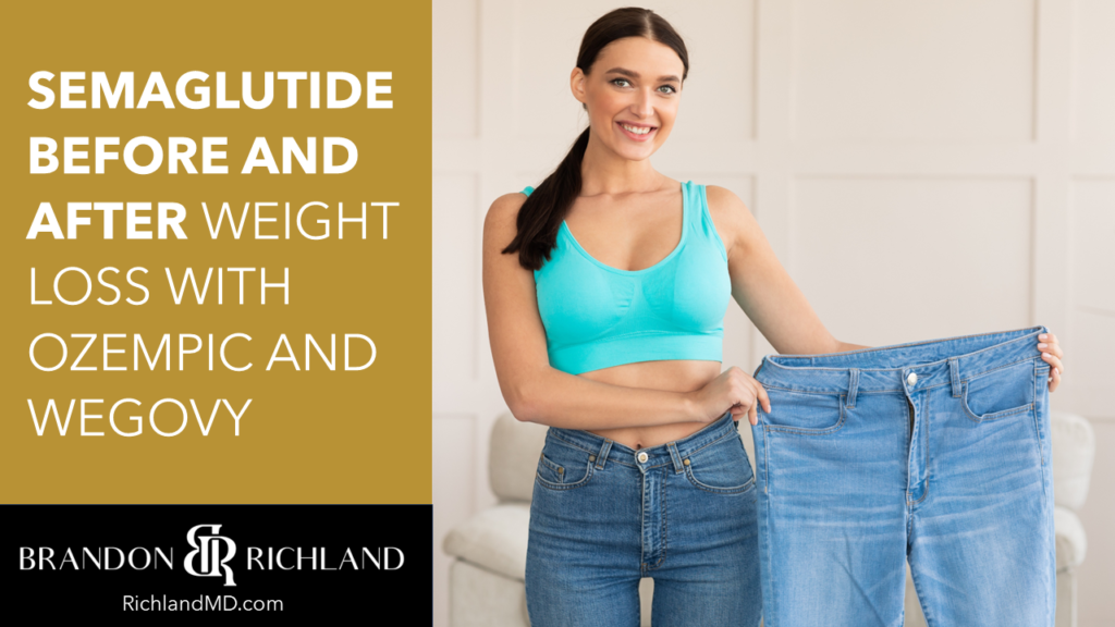 Semaglutide Before and After Weight Loss With Ozempic and Wegovy | Dr ...