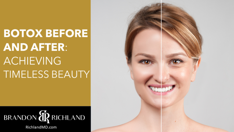 Botox Before and After: Achieving Timeless Beauty | Dr. Brandon ...