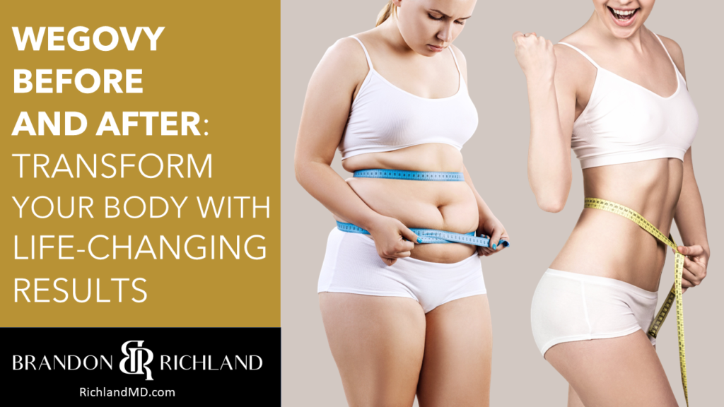 Wegovy Before and After: Transform Your Body with Life-Changing Results | Dr. Brandon Richland, MD
