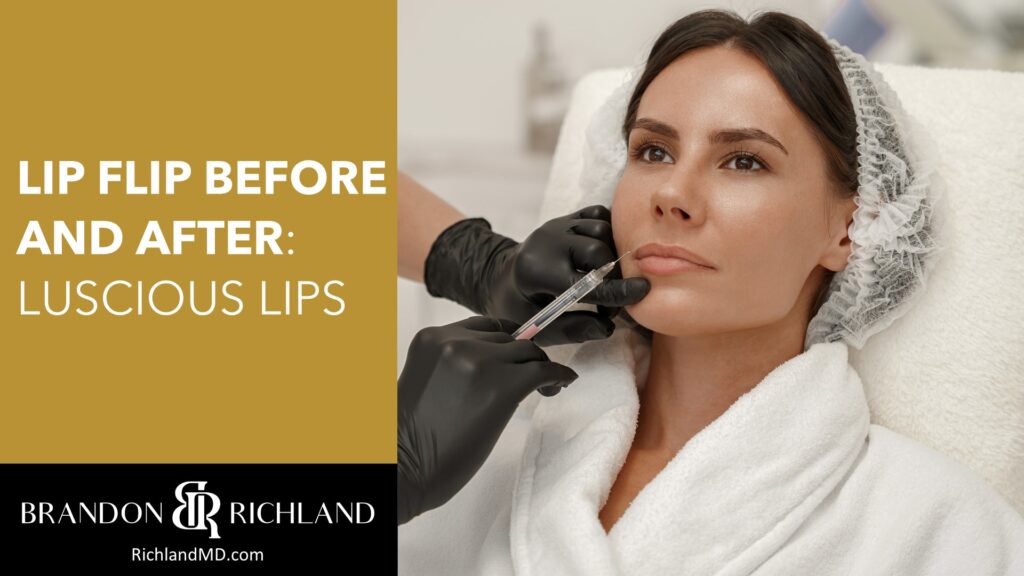 Lip Flip Before and After: Luscious Lips | Dr. Brandon Richland, MD
