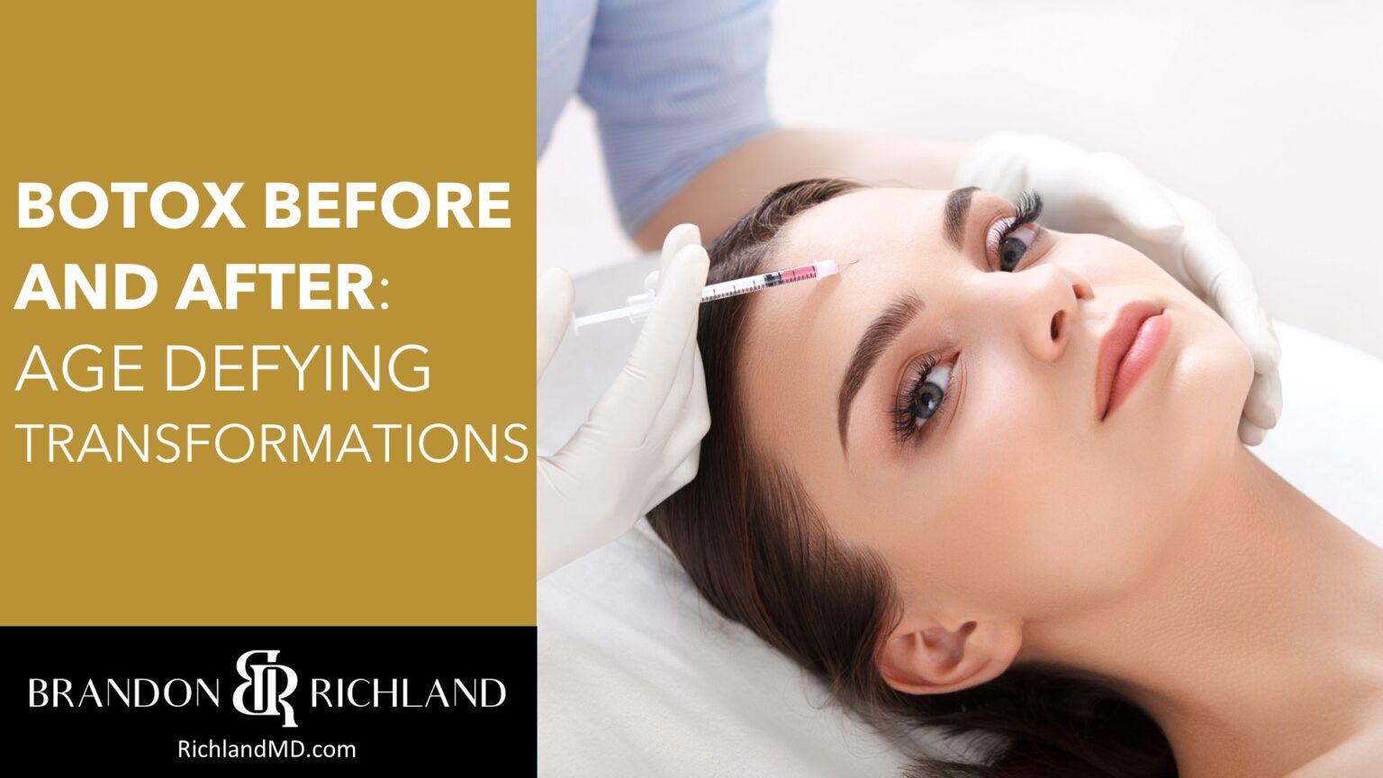Botox Before and After: Age Defying Transformations | Dr. Brandon ...
