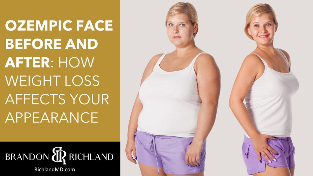 Ozempic Face Before and After: How Weight Loss Affects Your Appearance | Dr. Brandon Richland, MD