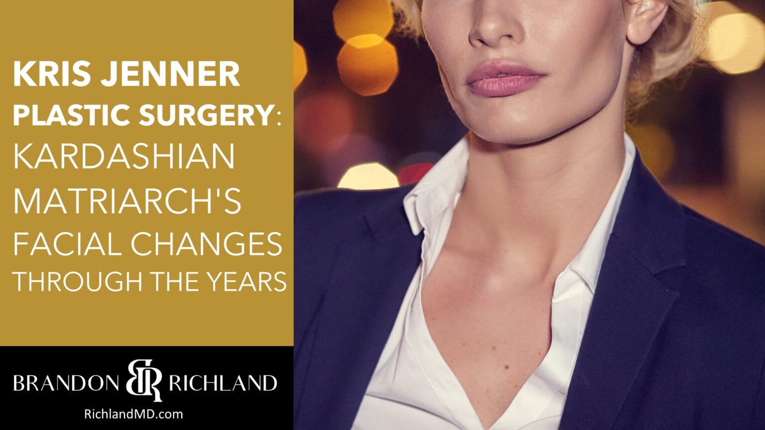 Kris Jenner Plastic Surgery: Kardashian Matriarch's Facial Changes ...