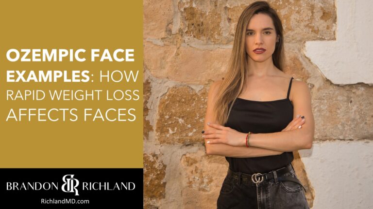 Ozempic Face Examples: How Rapid Weight Loss Affects Faces | Dr ...